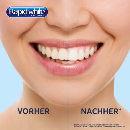 Rapid white Bleaching Strips, 12 St dauerhaft günstig online kaufen | dm.de