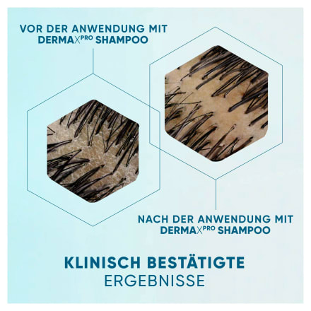 head&shoulders Shampoo Derma x Pro Sensitive Pflege, 250 ml dauerhaft ...