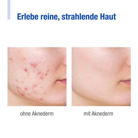 Aknederm Gesichtscreme H, 30 g dauerhaft günstig online kaufen | dm.de